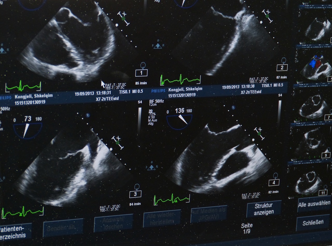 Echographie datation : comment cela se passe